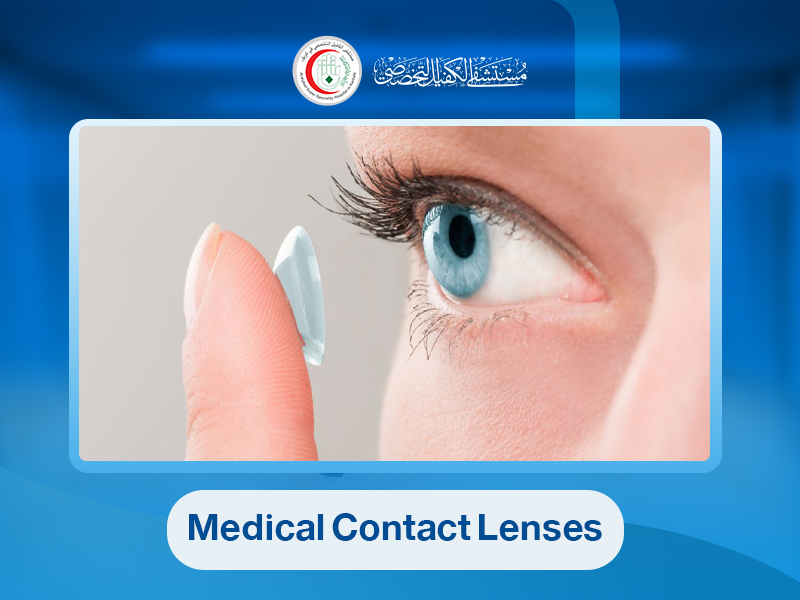 Medical Contact Lenses